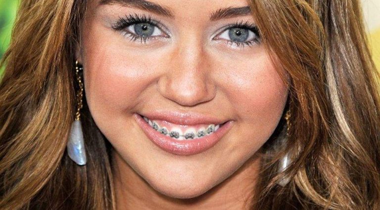 Did Miley Cyrus Get Dental Veneers?