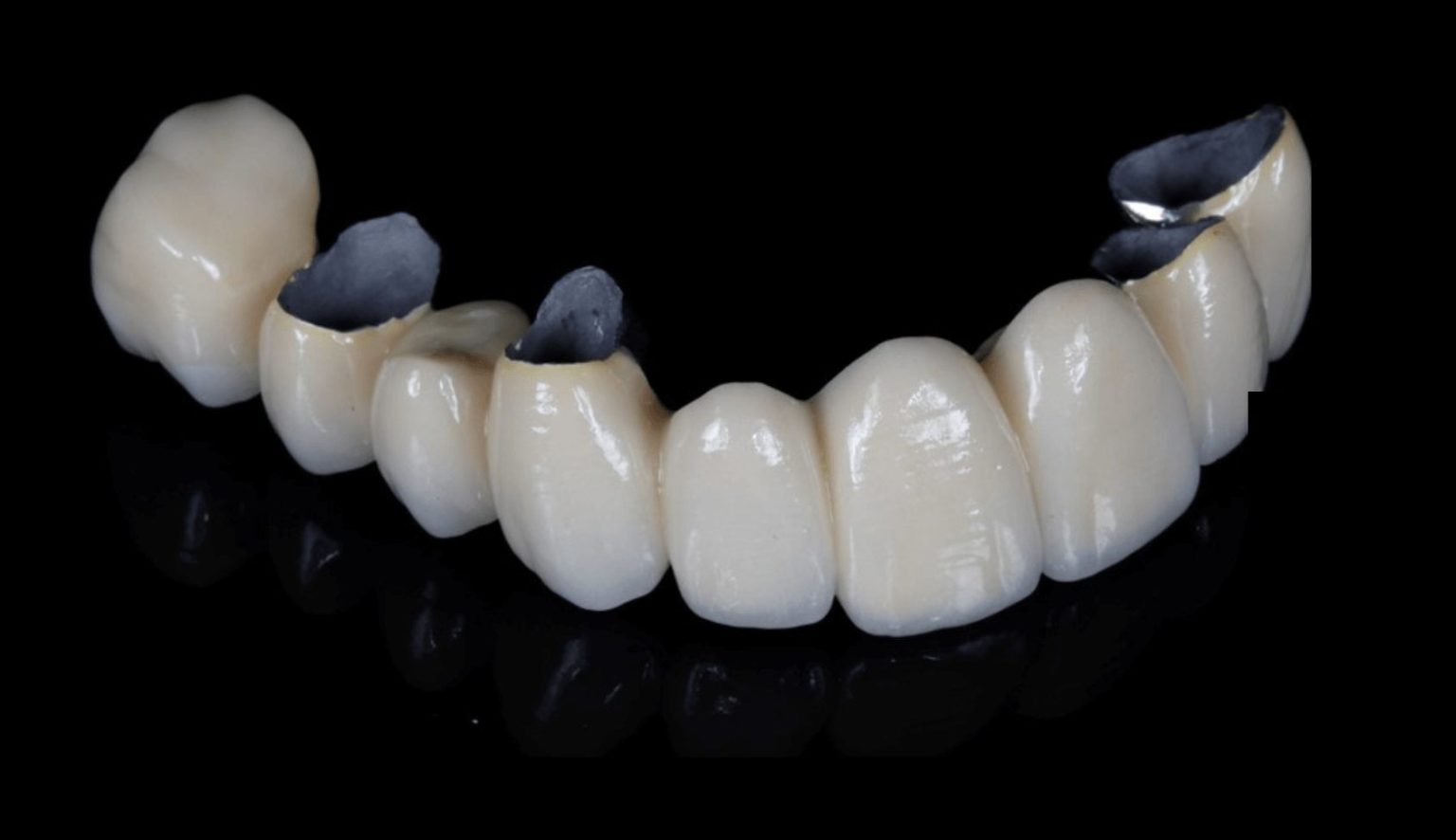 Metal Porcelain Crowns Price and Procedure in Turkey