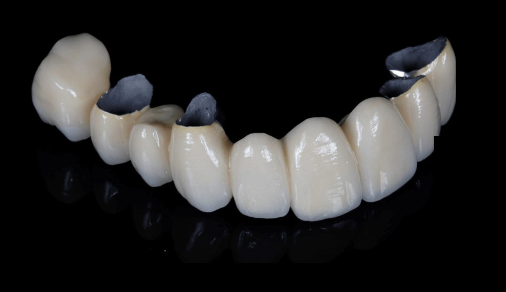 Metal Porcelain Crowns Price and Procedure in Turkey